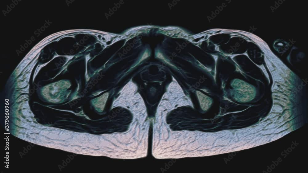 Bulk multicolored MRI of the female pelvic organs, abdominal cavity ...
