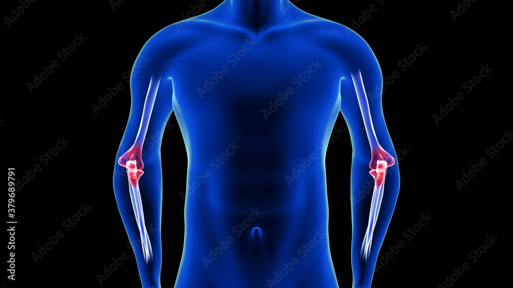 Elbow Pain illustration front view close-up. Blue Human Anatomy Body 3D ...
