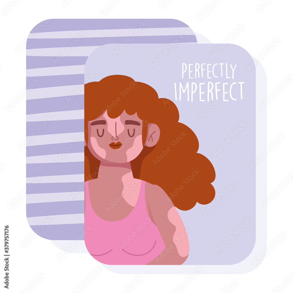 perfectly imperfect, cartoon woman curly hair and vitiligo disease ...