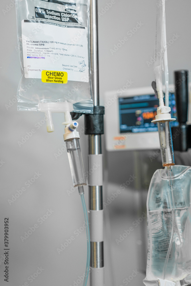 IV Infusion of Chemo Cancer Treatment Stock Photo | Adobe Stock