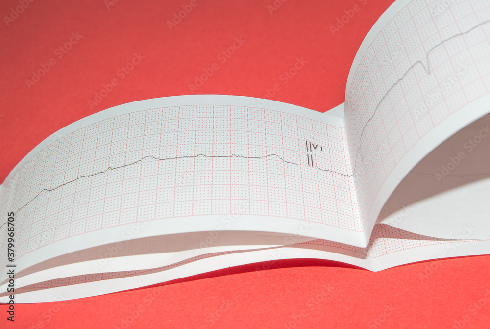 Heart rate on paper for recording an electrocardiogram, prevention of ...