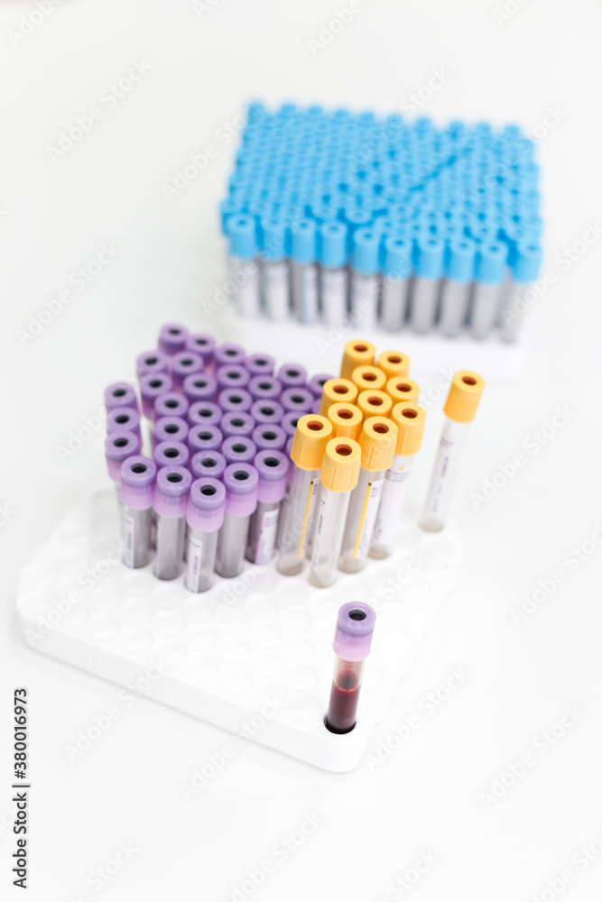 Blood sample in the tube on top of a white table in a laboratory Stock ...