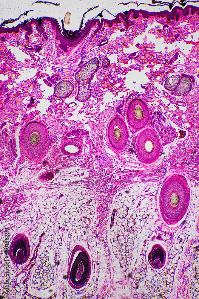 Human skin showing hair follicles Stock Photo | Adobe Stock