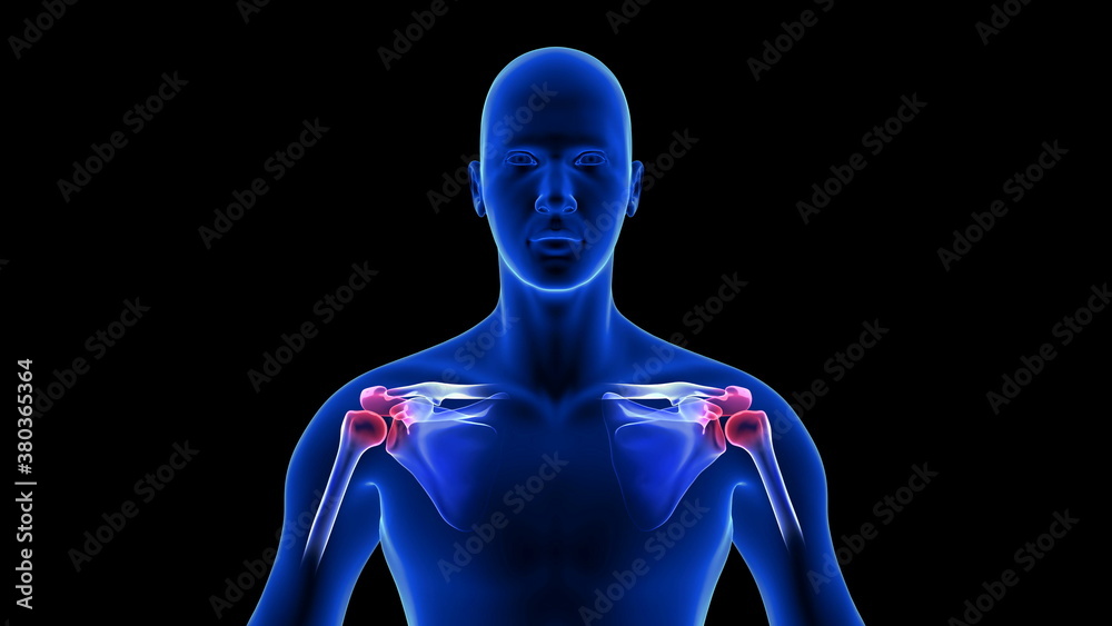 Shoulders Pain close-up illustration - front view. Blue Human Anatomy ...