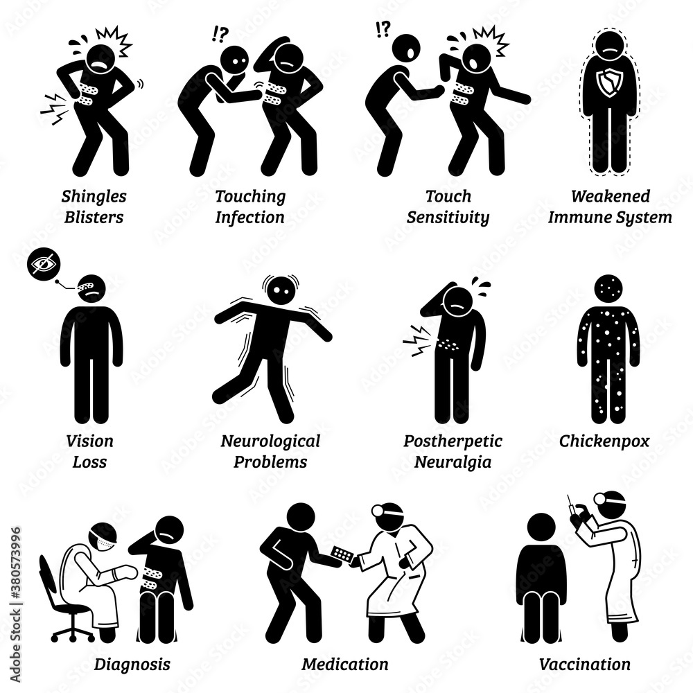 Shingles disease symptoms and complications icons. Vector illustrations ...