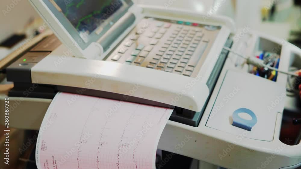 Closeup shot of ECG or electrocardiograph EKG machine display and print ...