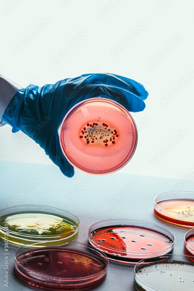 Woman hand holding a microbiology culture Stock Photo | Adobe Stock