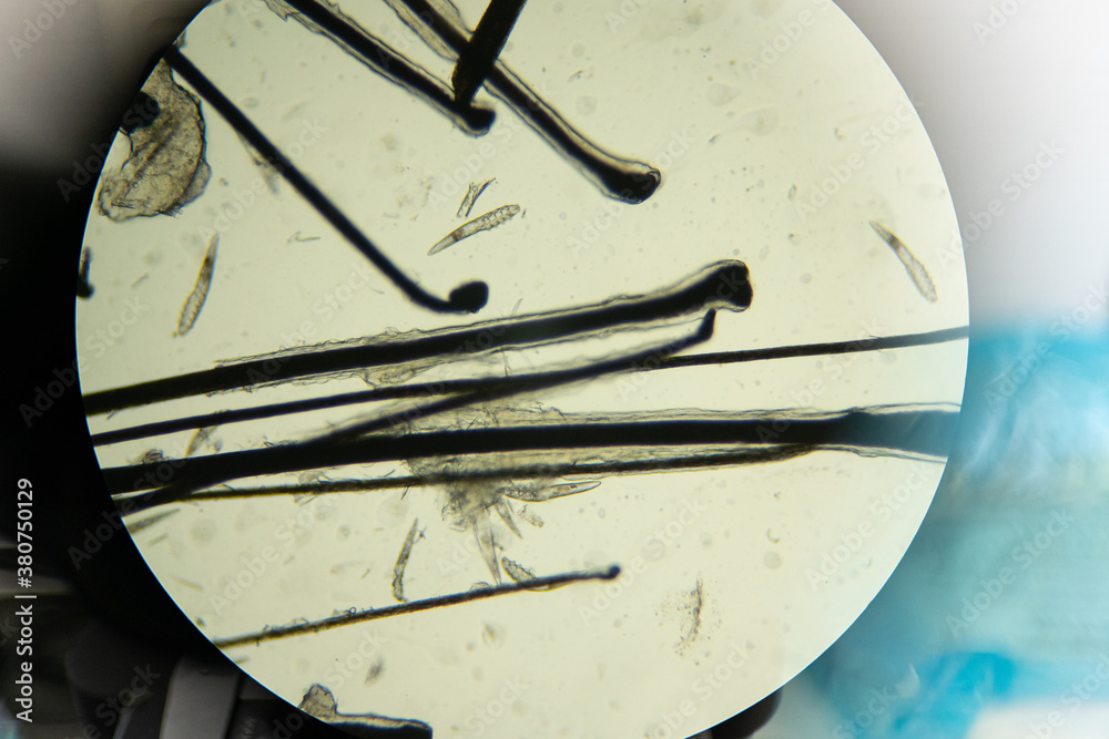 Top view of hair with small parasites placed under lens of modern ...