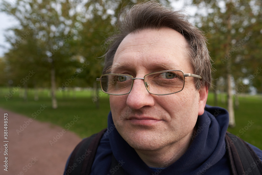 Male with visual impairment, exotropia, visual impairment slanted eyes ...