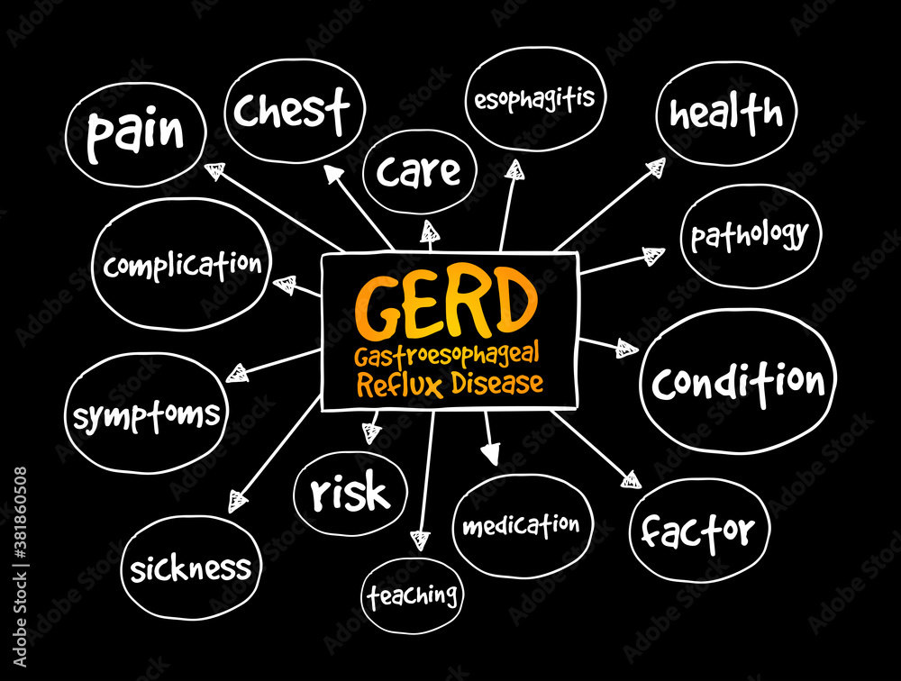 GERD - Gastroesophageal Reflux Disease mind map, medical concept for ...