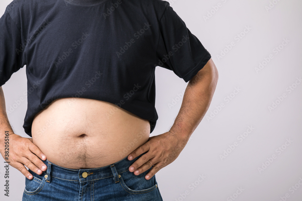 Medical check up concept : Fat people showing his big belly. Used for ...
