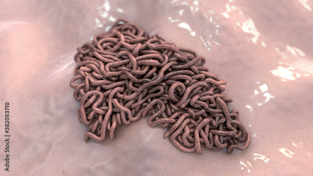 Parasitic worms in intestine Stock Illustration | Adobe Stock