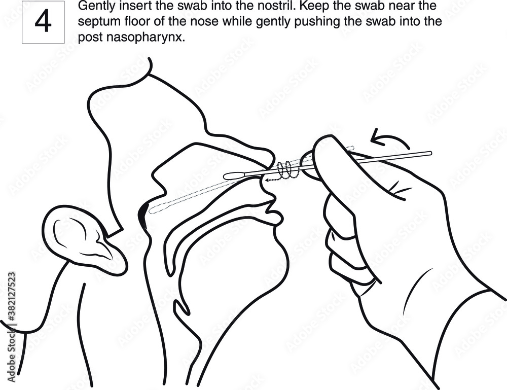 Gently insert the swab into the nostril. Keep the swab near the septum ...