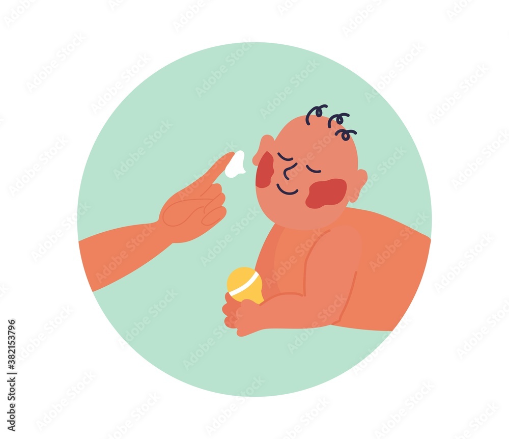 nursing baby with rash on face. Atopic dermatitis, eczema, irritation ...