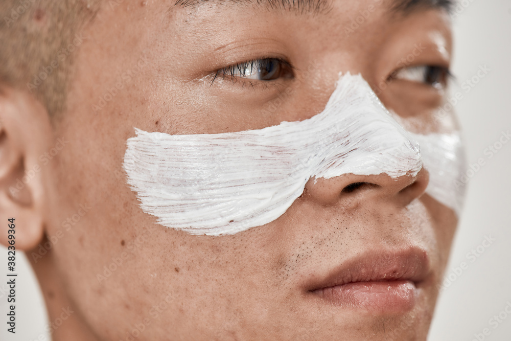 Foto de Close up of face of young asian man with problematic skin and ...