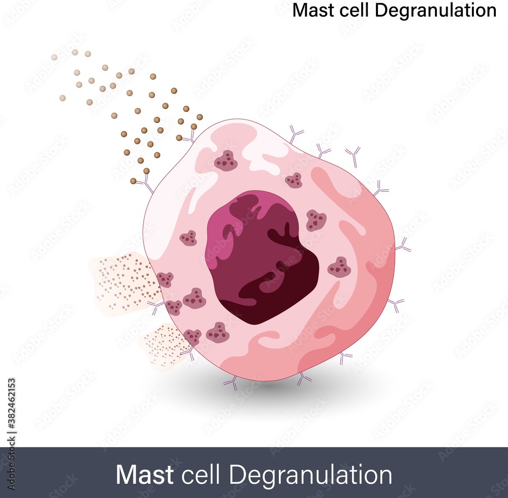 mechanism Of Mast cell degranulation during the allergic reaction Stock ...