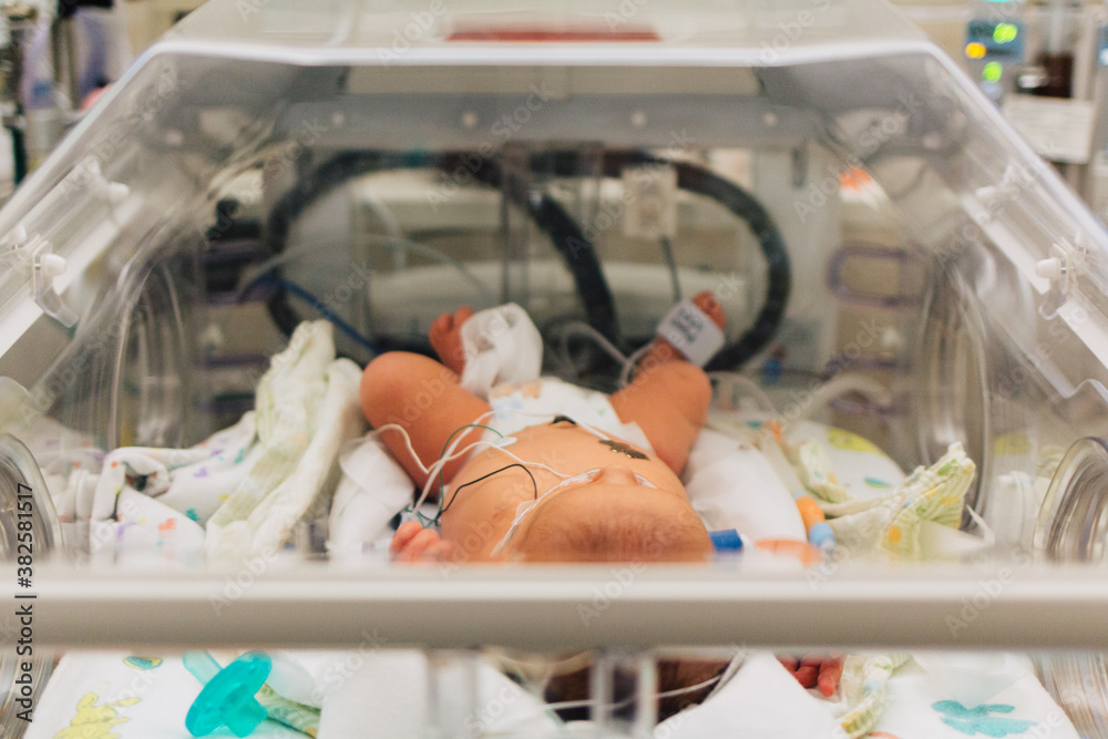Newborn baby boy in an isolette in a neonatal intensive care unit ...