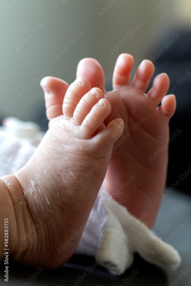 A portrait of the small cute feet of a baby. The skin is peeling a bit ...