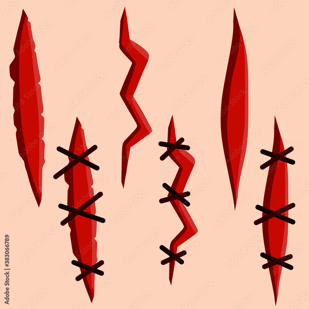 Bloody wound. Set of scratches. Stitches and medical care. Template for ...