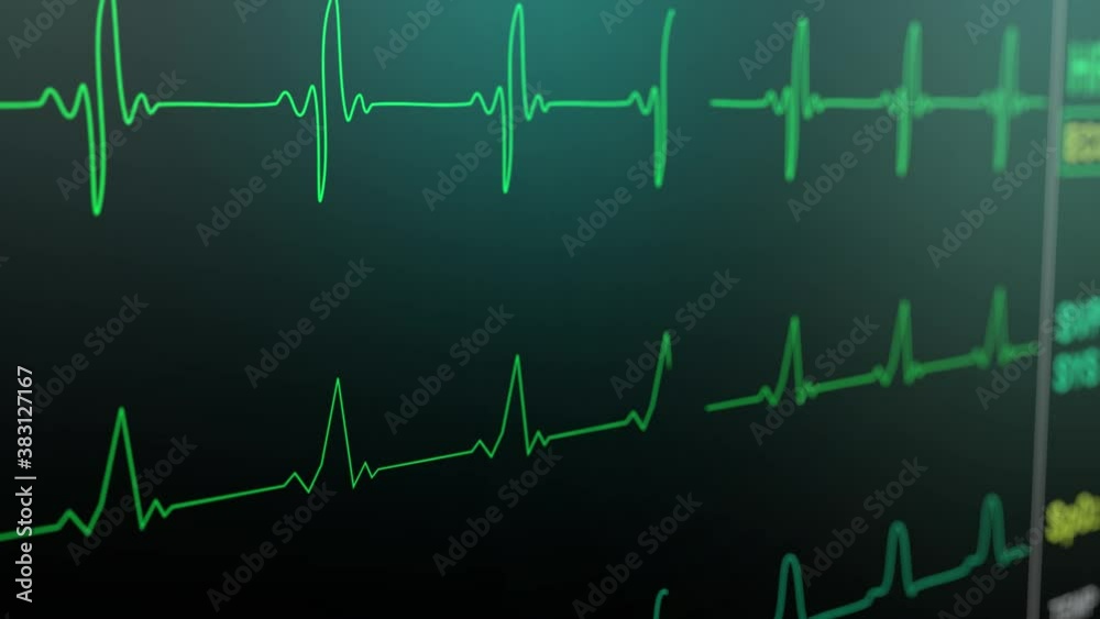 Heart rate monitor in hospital theater. Medical vital signs monitor ...