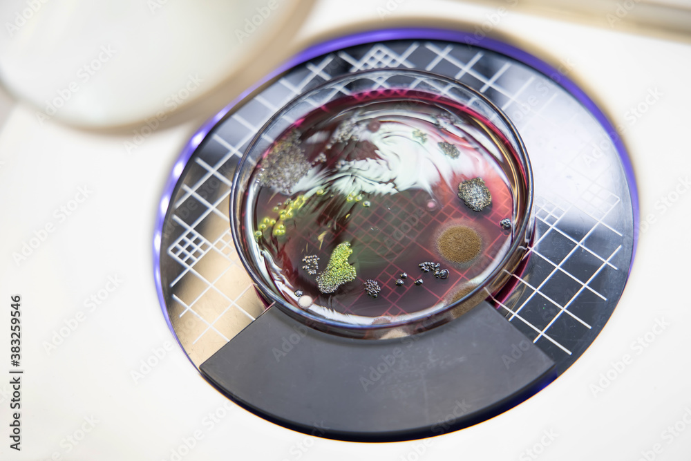 Bacteria Escherichia coli (E. coli) culture in petri dish with ...