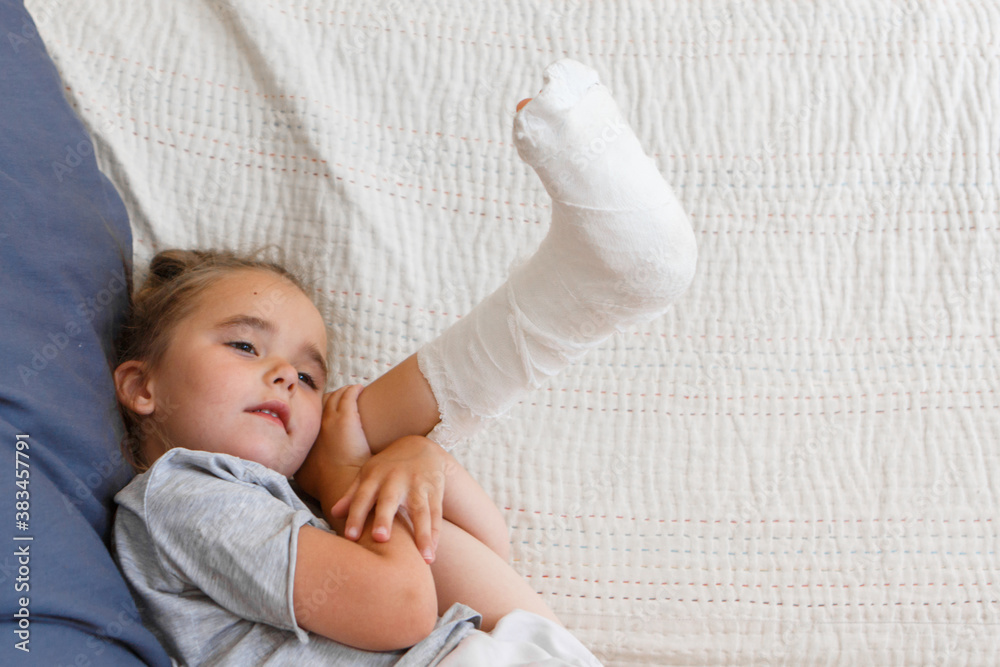 broken leg. Close-up of the cast on the feet. exercises to repair and ...