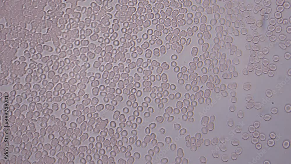 Red blood cells close up. Human blood under a microscope. Leukocyte ...