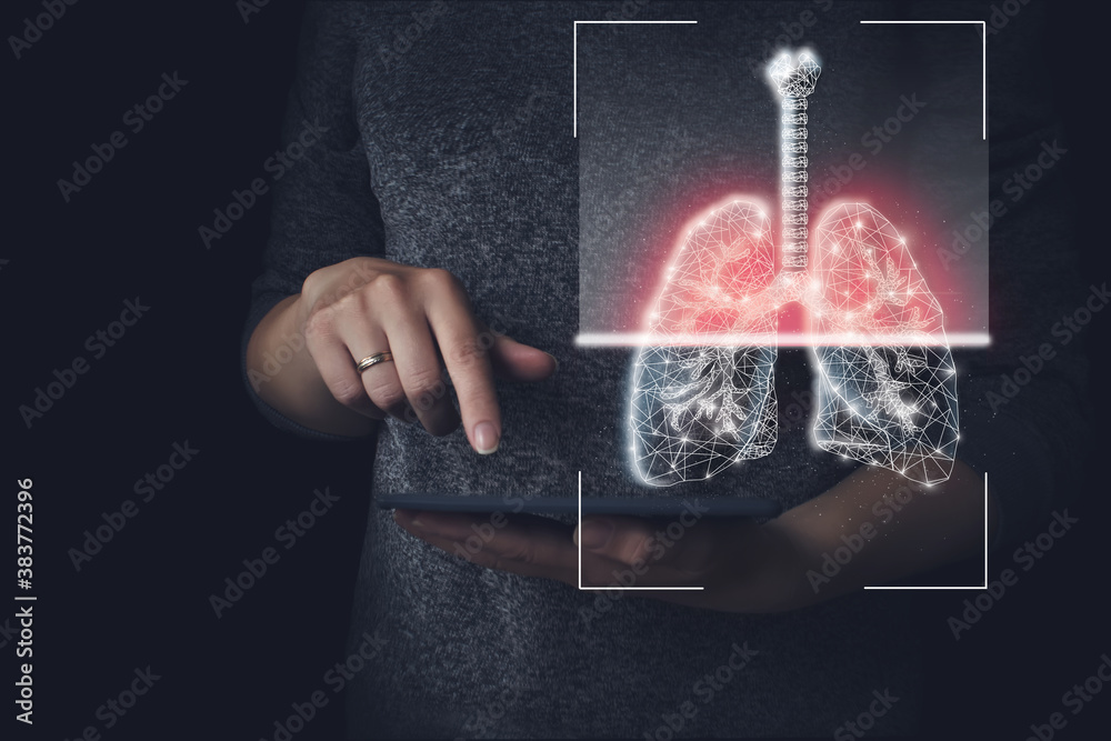 Covid-19. Human lungs scanning. Sars disease, coronaviruses in the lung ...