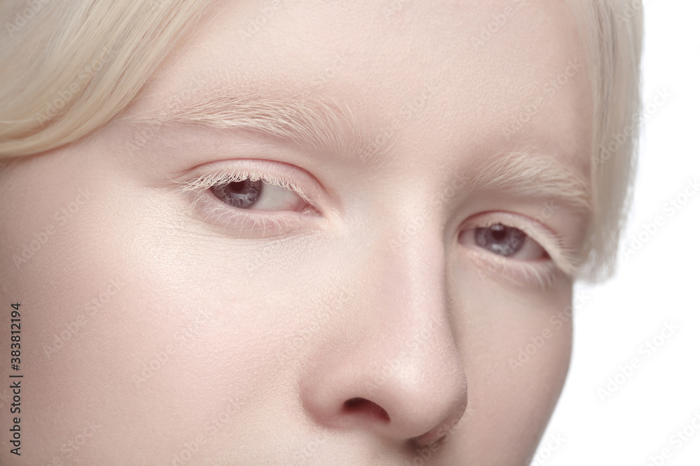 Eyes. Close up portrait of beautiful albino woman isolated on white ...