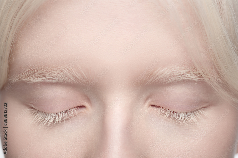 Eyes closed. Close up portrait of beautiful albino woman isolated on ...