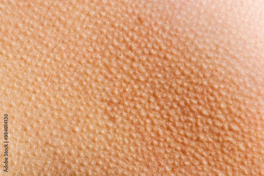 Goosebumps Skin Background Stock Photo | Adobe Stock