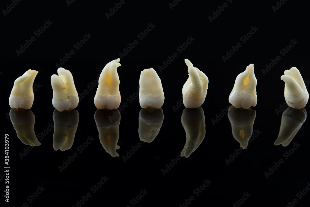 Seven removed diseased human teeth stacked in a row on black background ...