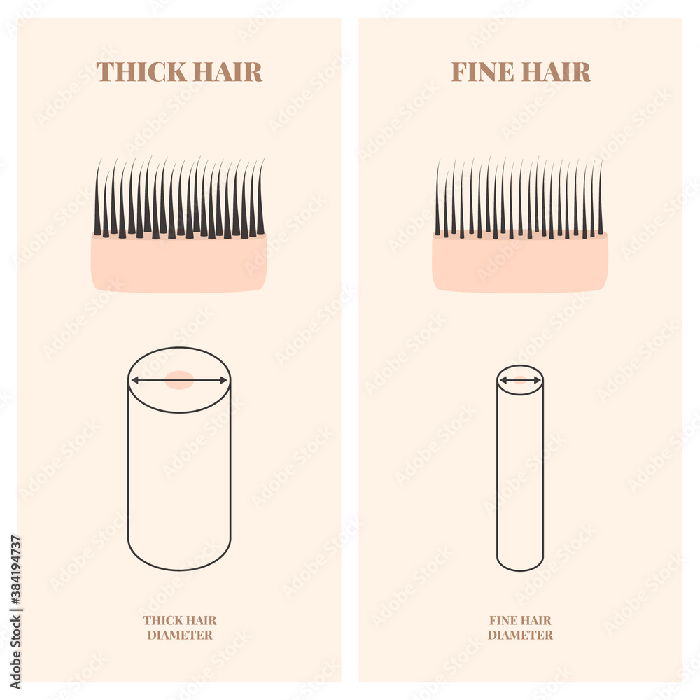Hair thickness types classification set. Skin cross-section with fine ...