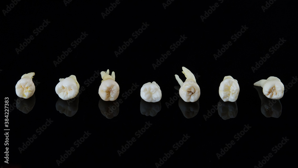 Torn human teeth stacked in a row on a black background. Close-up photo ...