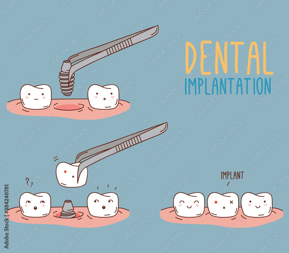 Comics about tooth replacement. Vector illustration for children ...