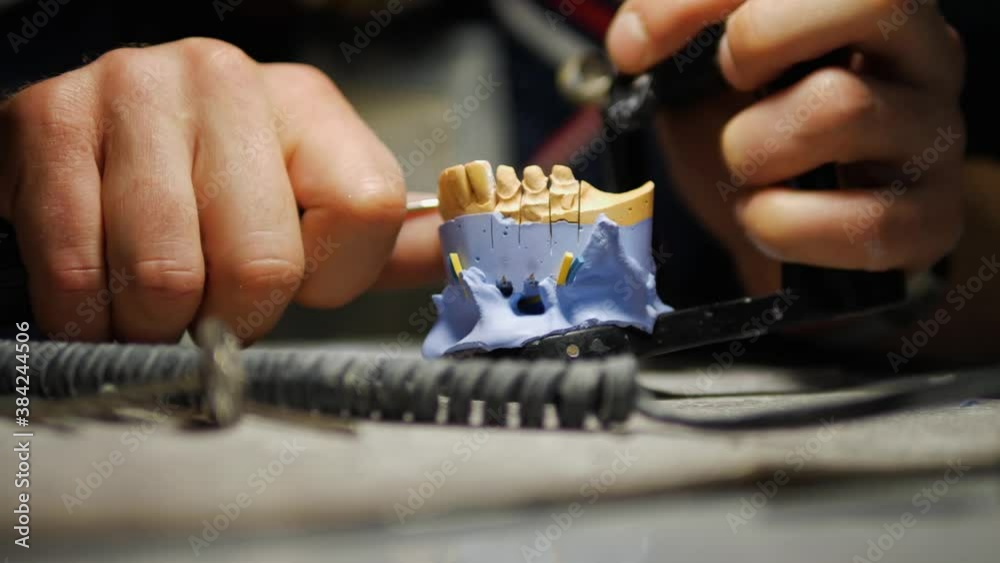 Dental technician work,tooth sharpening,denture tooth milling,ceramic ...