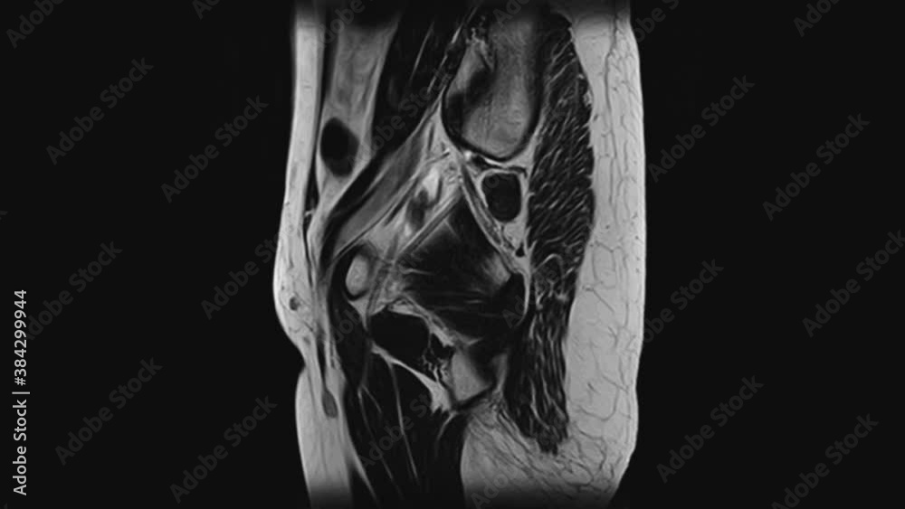 MRI of the female pelvic organs, abdominal cavity, gastrointestinal ...