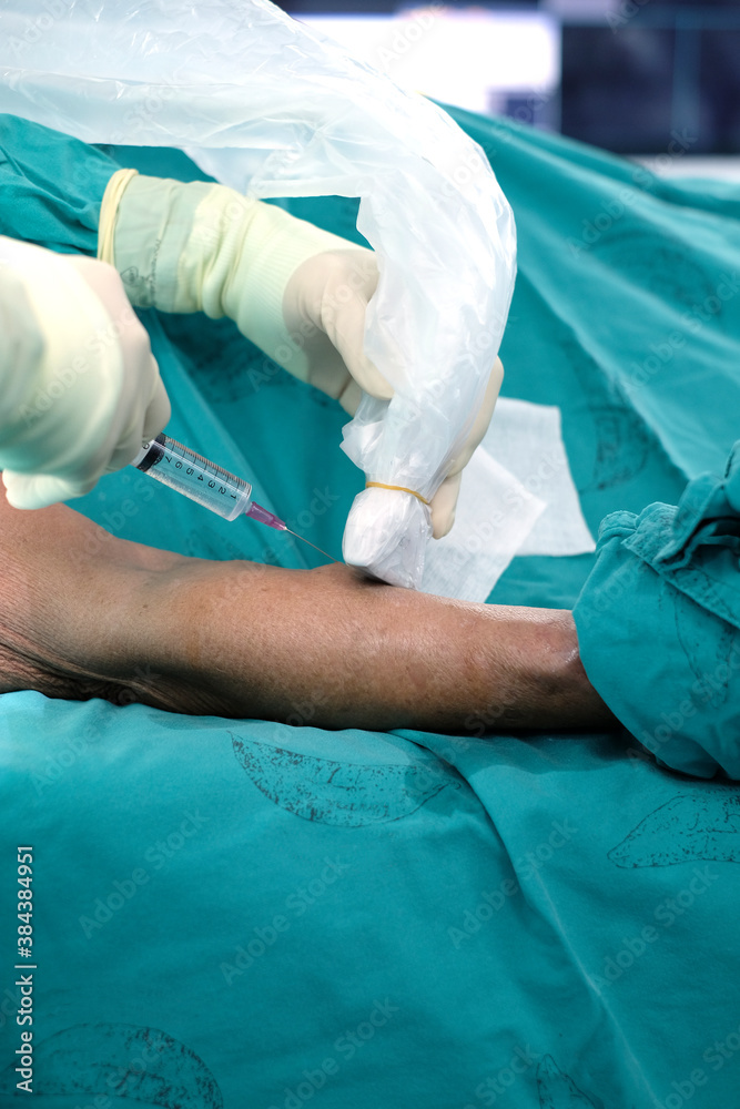 Doctor use ultrasound probe to assessment vascular blood flow and ...