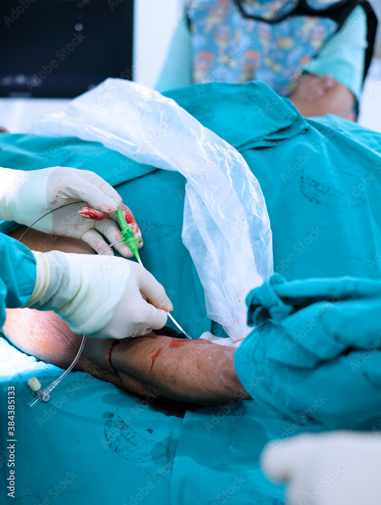 doctor accessed 6 Fr introducer sheath to ulnar artery of patient Stock ...