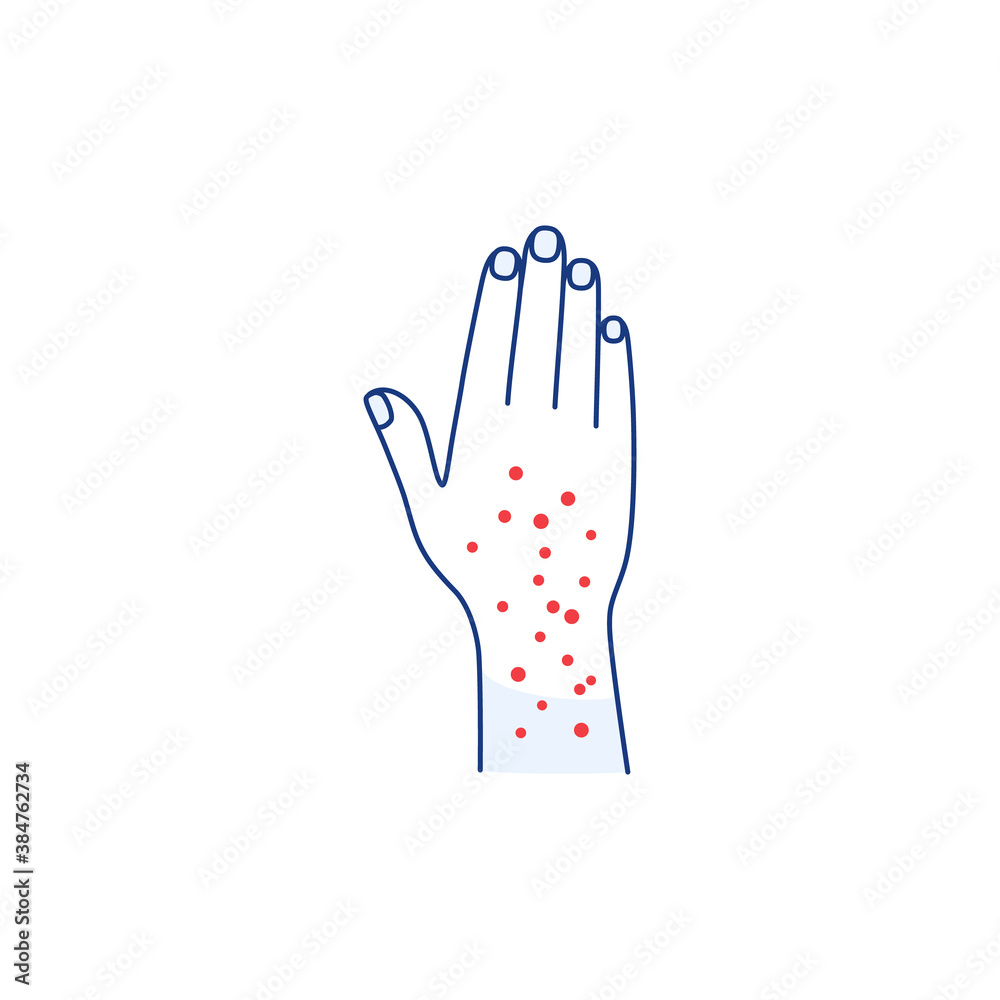 Skin rash thin line icon isolated on white background. Color outline ...