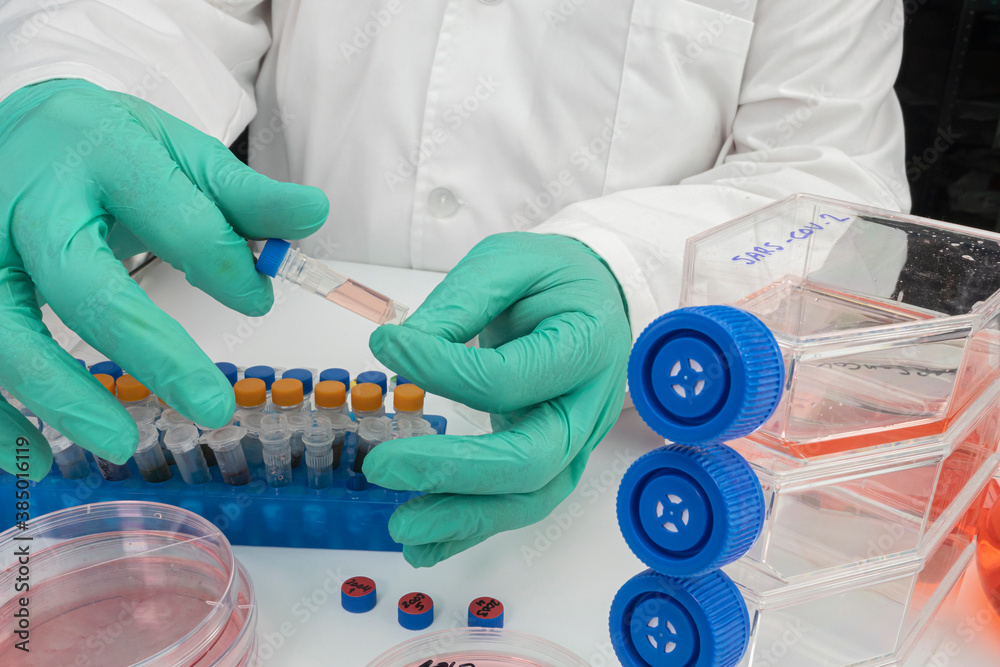 Scientist working on sars-cov-2 coronavirus covid-19 on a petri dish in ...