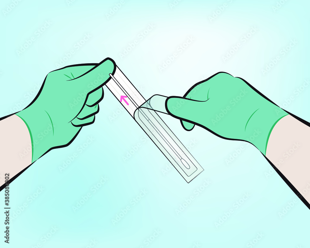 Step 2 : Open the collection swab wrapper by peeling open the top of ...