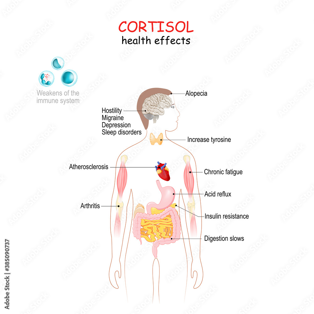 Cortisol health effects. Human's body with internal organs affected by ...