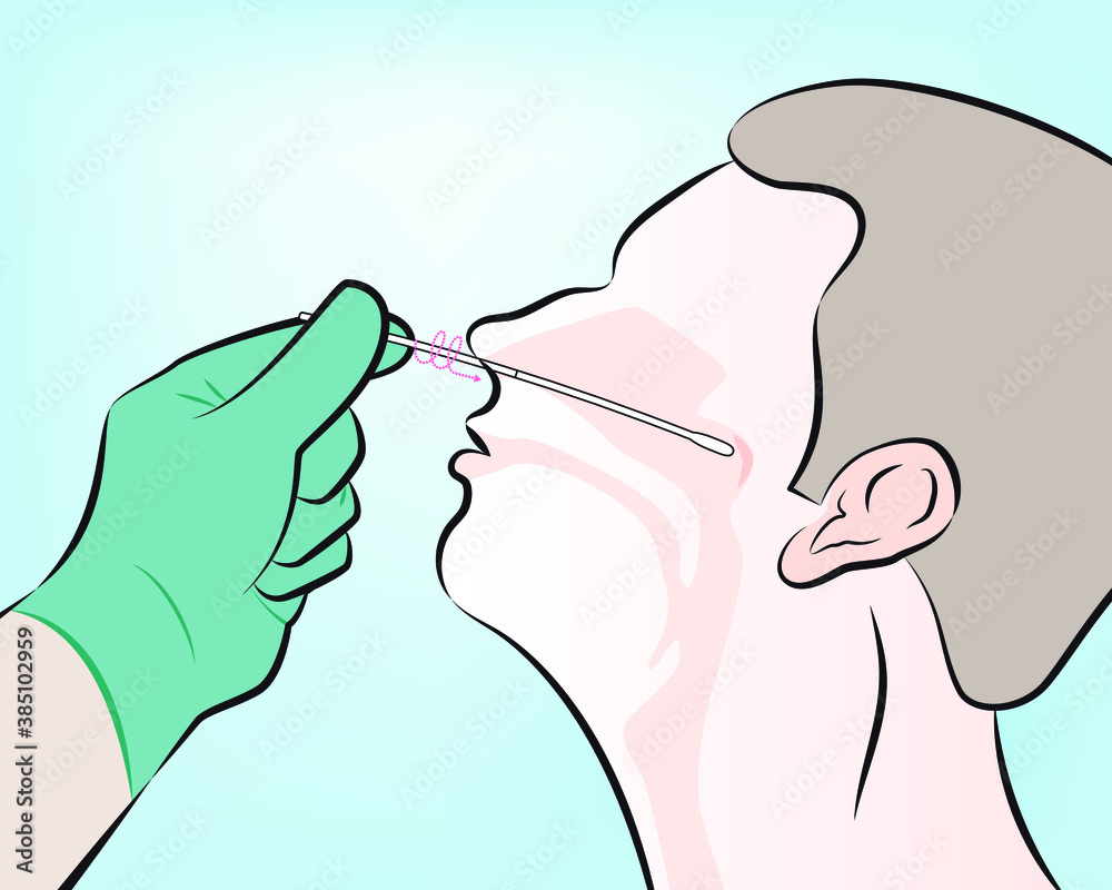 Step 5 : As a visual reference, the swab should be inserted about half ...