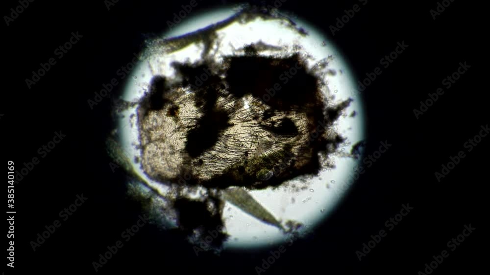 A decaying mite corpse populated by various protozoan infusoria. Theme ...