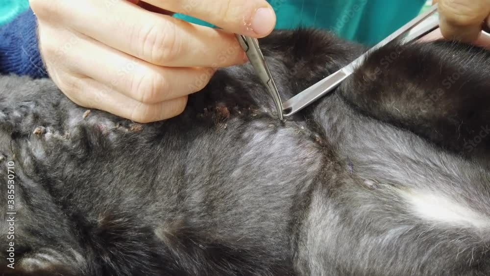 Removing a surgical suture from an incision wound after a mastectomy ...