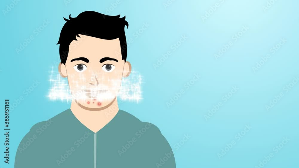 2d animation woman face with acne scar transform to clean and clear ...