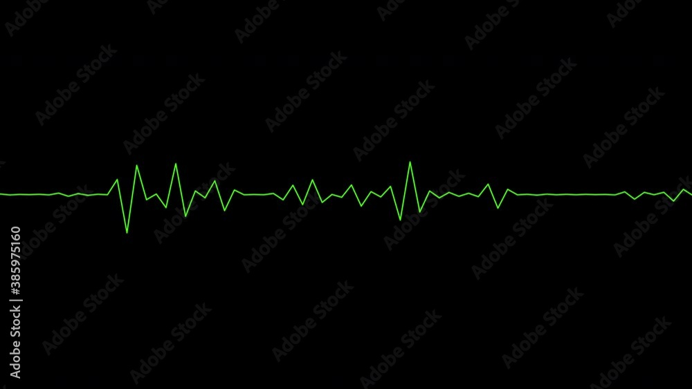 Electrocardiogram is a medical examination to see the electrical ...