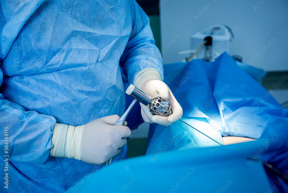 Surgeon performs endoscopic microdiscectomy of herniated intervertebral ...