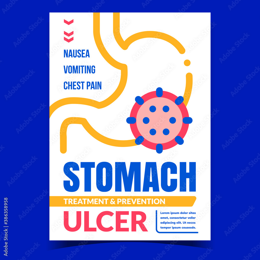 Stomach Ulcer Creative Promotional Poster Vector. Stomach Disease ...